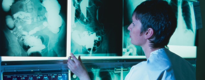 Sun Nuclear | Mirion